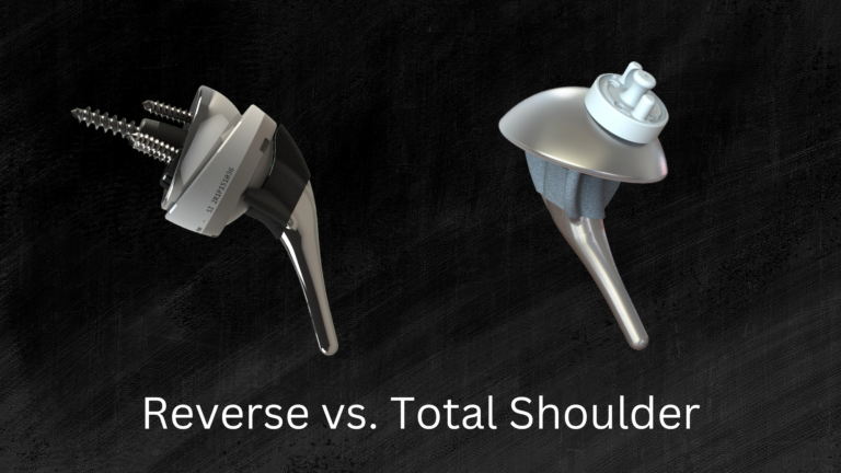 Reverse Total Shoulder vs. Total Shoulder – Dr. Amit Nathani, MD